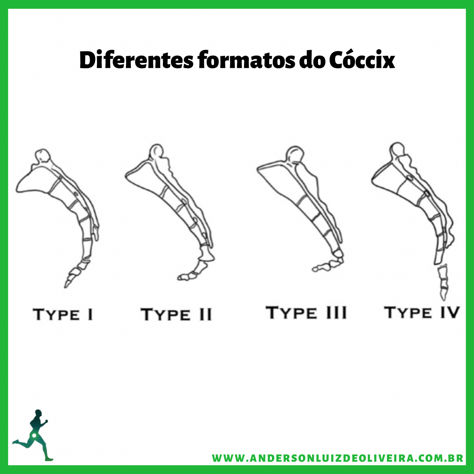 Dor no Cóccix (Coccigodínea) - Dr. Anderson Luiz de Oliveira